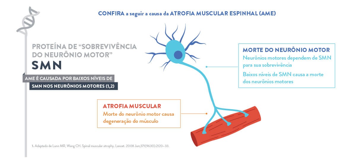 Infográfico sobre a causa genética da Atrofia Muscular Espinhal (AME)